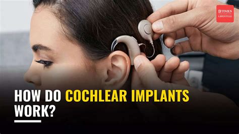 How Do Cochlear Implants Work