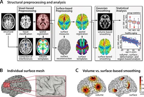 The Preprocessing Of Structural MRIs Often Contains A Voxel Based Part Download Scientific