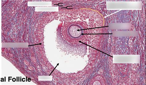 Lecture 20 Diagram Quizlet