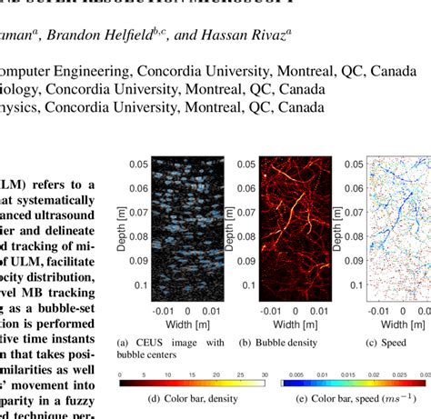 Results For The Low Frequency Synthetic Dataset A Shows A Ceus Image