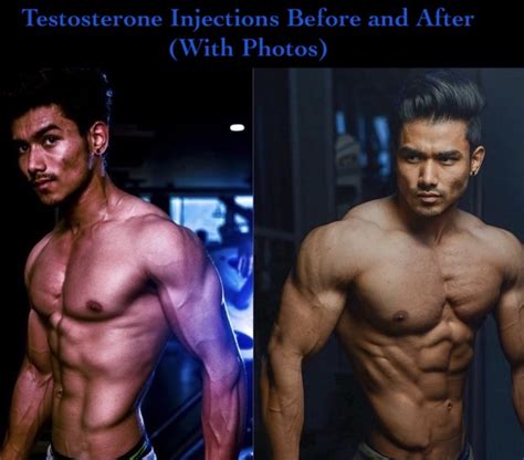 Testosterone Injections Before And After Photos Suppsforlife