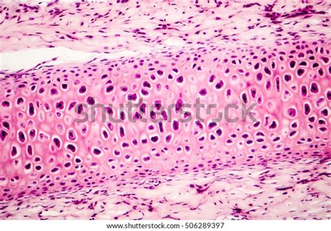 Compact Bone Micrograph Light Microscopy Bone Stock Photo Edit Now 506289397