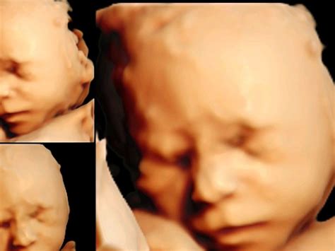 Sachin Awasthi On Linkedin How 3d4d Face Reconstruction Can Be Done