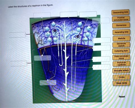 Solved Label The Structures Of A Nephron In The Figure Descending Limb Proximal Convoluted