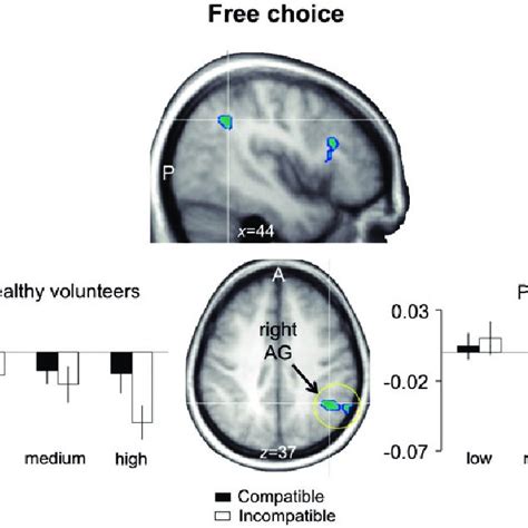 Parametric Modulation Of Angular Gyrus Activation During Action