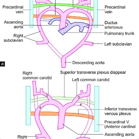 Scheme Showing The Development Of Arch Of Aorta And Its Branches A Download Scientific