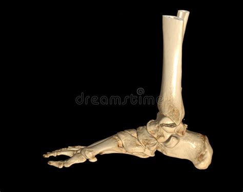 Ct Scan Ankle And Foot Stock Illustration Illustration Of Arthritis