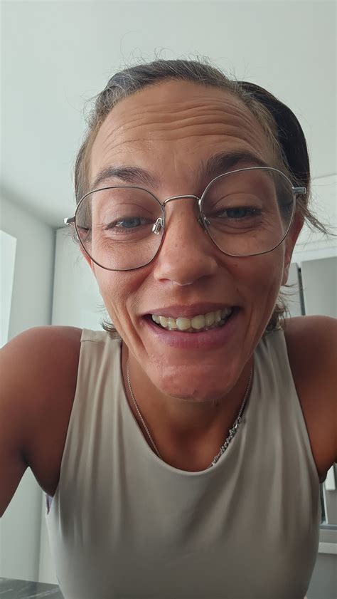 Before Aligners Aligner 13 15 Wow R Invisalign