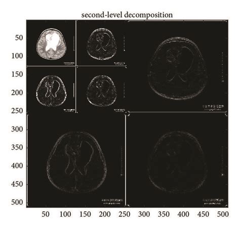 Schematic Of Brain Mri Image By 2 Level Discrete Wavelet Decomposition Download Scientific Diagram