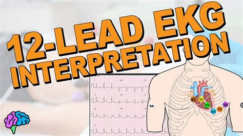 The Complete 12 Lead Ekg Masterclass Youtube