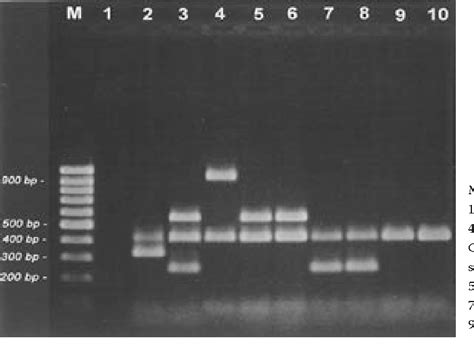 Figure 1 From Typing Of Isolates Of Clostridium Perfringens From Healthy And Diseased Sheep By