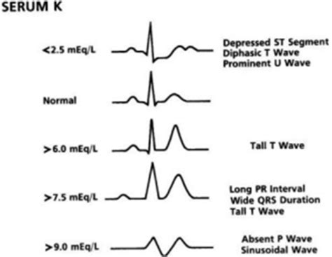 Electrolyte Abnormalities Flashcards Quizlet