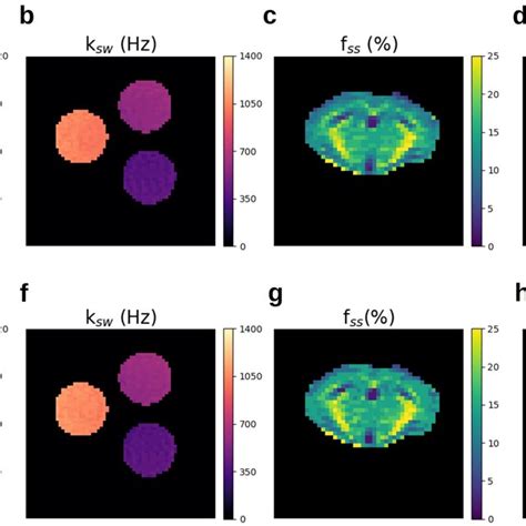 Magnetic Resonance Fingerprinting Quantitative Reconstruction Of Download Scientific Diagram