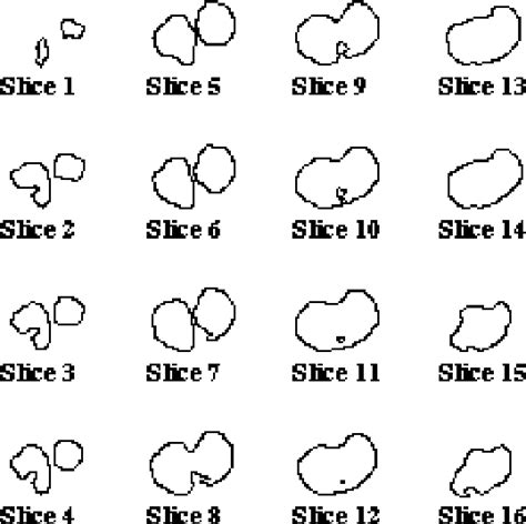 figure 21 from an image space algorithm for morphological contour