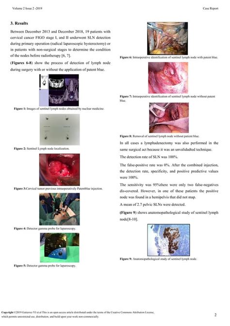 Sentinel Lymph Node Detection In Patients With Cervical Cancer Case