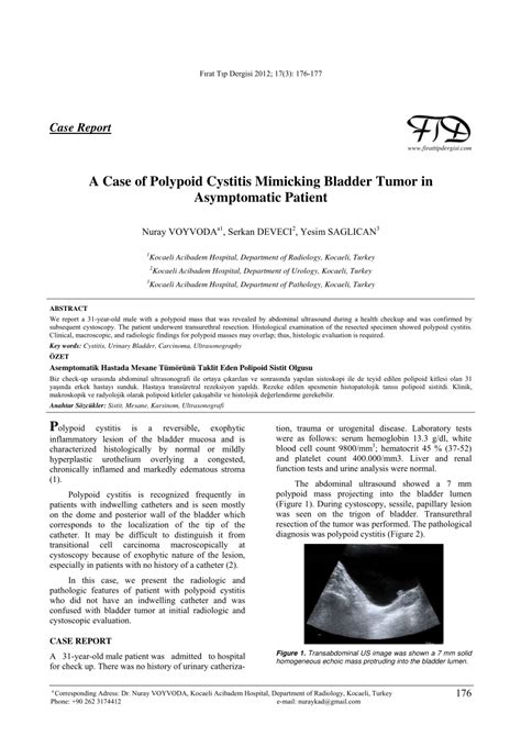 Pdf A Case Of Polypoid Cystitis Mimicking Bladder Tumor In