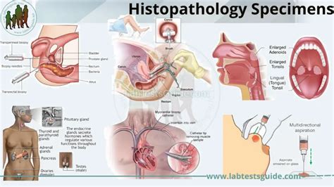 Histopathology Specimens Defination And Site Of Collection Lab Tests