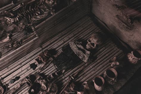 Long Bone Labeling Quiz