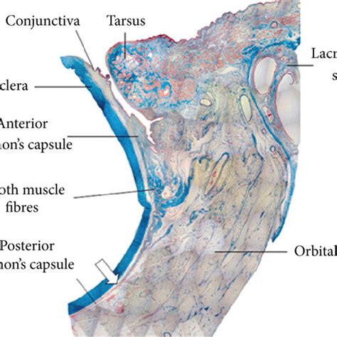 The Structure Of The Tenons Capsule A Superomedial Projection B Download Scientific