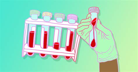 Tests For Hepatitis C Understanding Hep C Lab Results