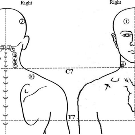 Location Of Trigger Points In The Head Neck Shoulder And Upper Back Download Scientific