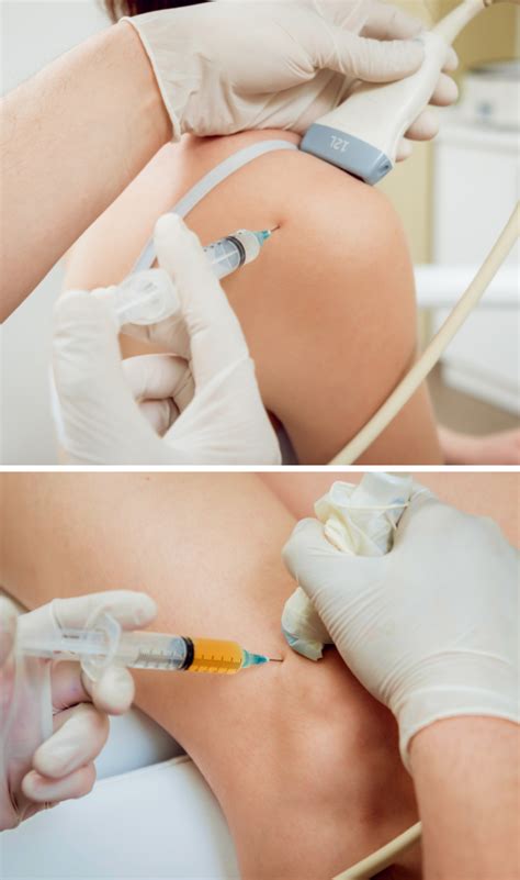 Ultrasound Guided Injection Ultrasound Guided Shoulder Joint And Bursa