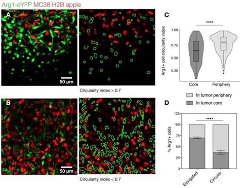 Arg1 Expression Defines Immunosuppressive Subsets Of Tumor Associated