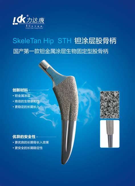 「攻克技术垄断」首款国产钽涂层股骨柄，彰显骨科研发技术创新 知乎