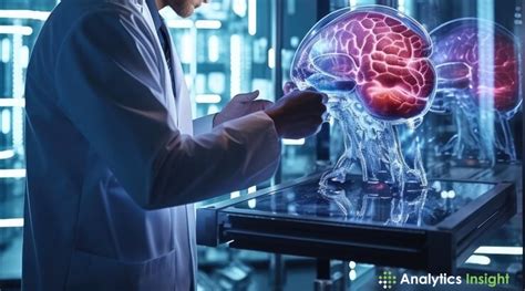 How Ai Detects Anxiety Through Brain Structure Analysis