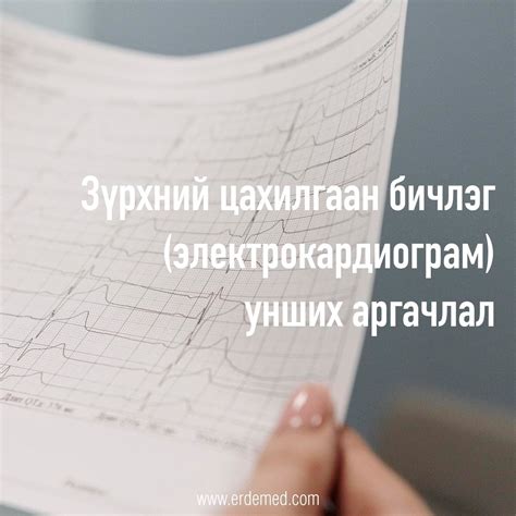 Erdemed Хэвийн зүрхний цахилгаан бичлэг нь зүрхний цикл тус бүрийн үед зүрхний янз бүрийн