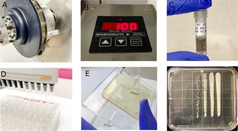 Video Intravitreal Injection And Quantitation Of Infection Parameters In A Mouse Model Of