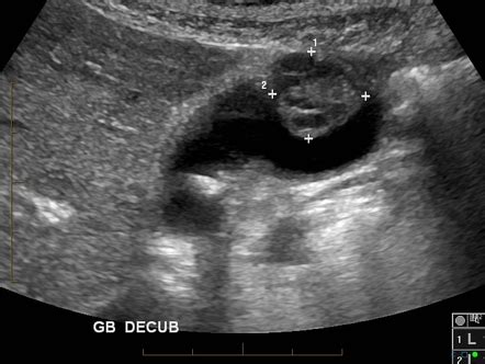 Radiology Quiz 33297