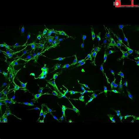 Human Aortic Adventitial Fibroblasts Haaf