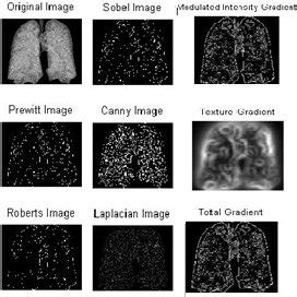 Edge Detection Schemes Download Scientific Diagram