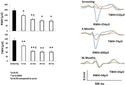 Left Panels Significant Improvement In R Wave And T Wave Heterogeneity Download Scientific