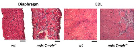 Extensive Fibrosis In Hande Muscle Cross Sections Of Edl And Diaphragm Download Scientific