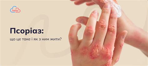 Helsi Me електронна медична система для пацієнтів та лікарів