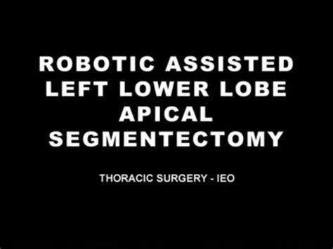 Robotic Assisted Left Lower Lobe Apical Segmentectomy On Vimeo