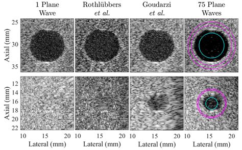 Example Results From The Lesion Test Set Taken From Dataset Sequences Download Scientific