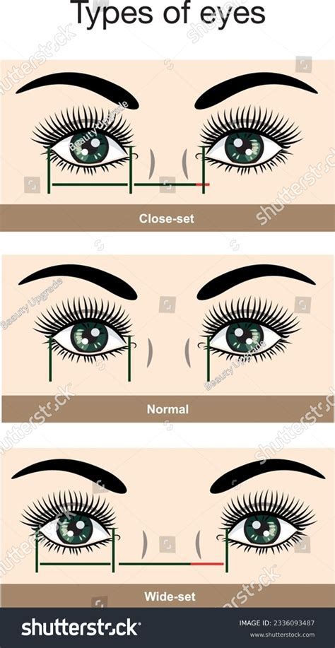 Close Set Eyes Vs Wide Set Eyes