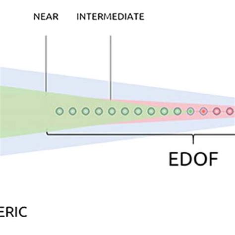 Mini Well Extended Depth Of Focus Edof Intraocular Lens Iol Basic