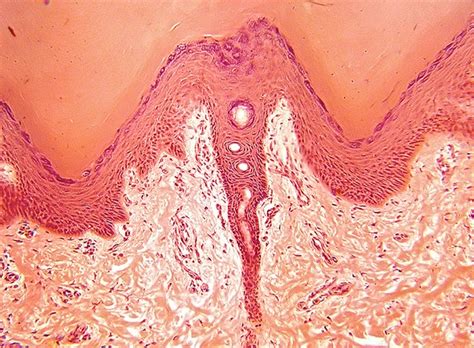 Colorazione Con Ematossilina Eosina Medicinapertutti It