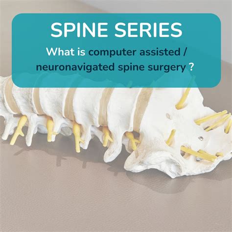 Miss Neuronavigationdevice Spinesurgery Gpeducation Patienteducation Neurospineinstitute