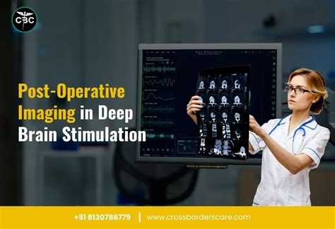 Deep Brain Stimulation Surgery India