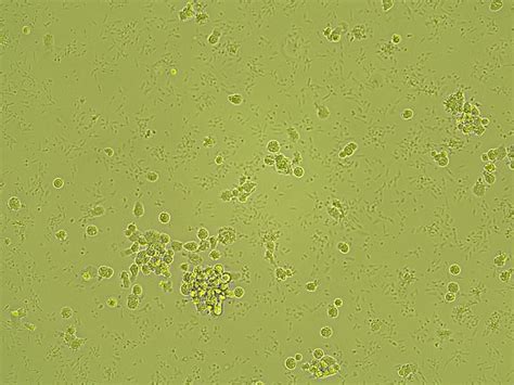 What Is Small Particle In The Background And How Can I Discard Them