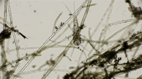 Larva Of Ephemeroptera Under A Microscope Stock Footage Videohive