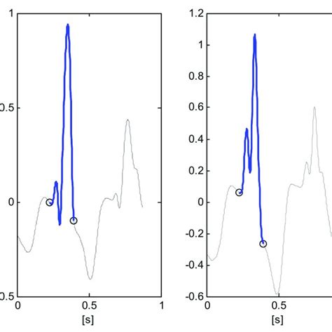 Signal Processing For The Detection Of RBBB File H03947 RBBB Download Scientific Diagram