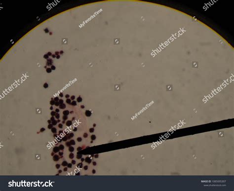 Yeast Budding Yeast Cryptococcus Neoformans Staining Stock Photo 1085005307 Shutterstock