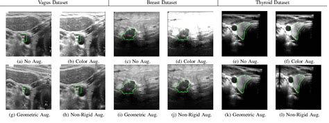Figure 1 From Data Augmentation Methods For Object Detection And