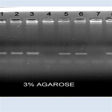 Amplification Refractory Mutation System Polymerase Chain Reaction Download Scientific Diagram